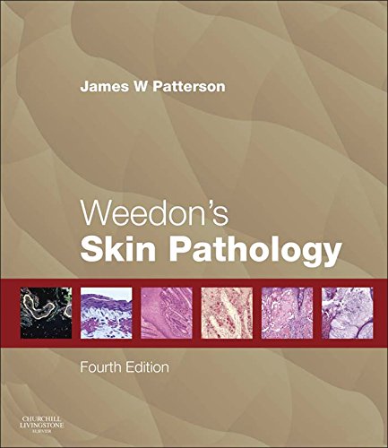 Weedon's Skin Pathology E-Book - PDF, Baixar eBook - 99ebooks